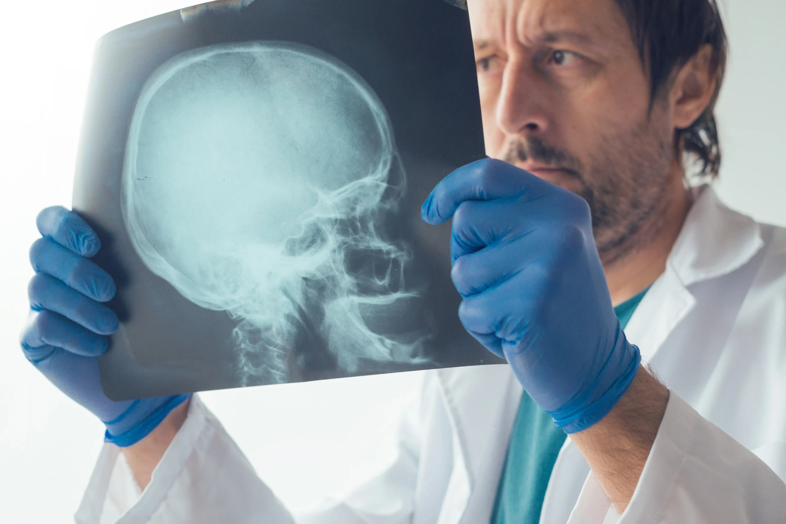 Riverside Traumatic Brain Injury Attorney | The JLF Firm